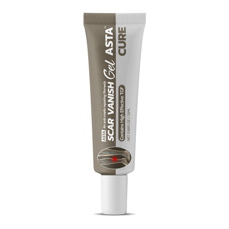 ASTACURE VARICOSE VEINS GEL 30g – P＆W APS